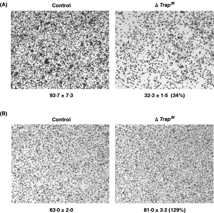 Role of selenium-containing proteins in T-cell and macrophage function ...