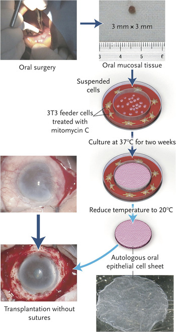 Cell sheet engineering for integrating functional tissue in vivo ...