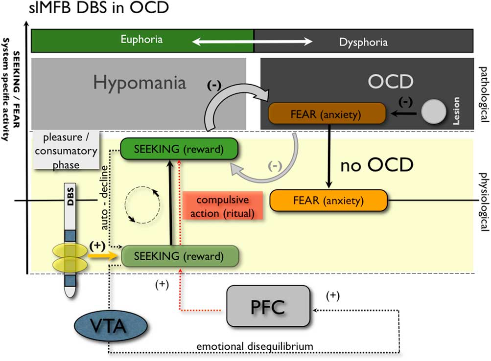 The medial forebrain bundle as a target for deep brain stimulation for ...