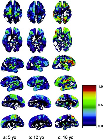 The changing impact of genes and environment on brain development ...