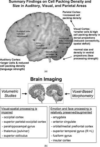 Defining the social phenotype in Williams syndrome: A model for linking ...