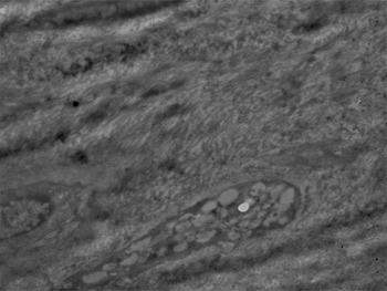 Structural characteristics of septal cartilage and mucoperichondrium ...