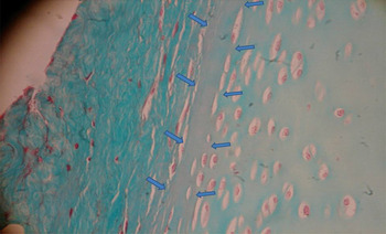 Structural characteristics of septal cartilage and mucoperichondrium ...