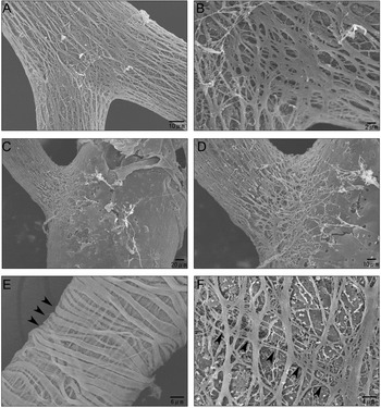 Architecture of the Subendothelial Elastic Fibers of Small Blood ...