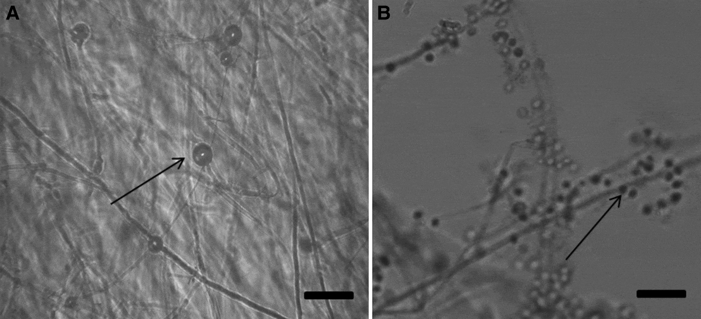 Novel lineage of a green alga and Acremonium stroudii (Ascomycota) sp ...