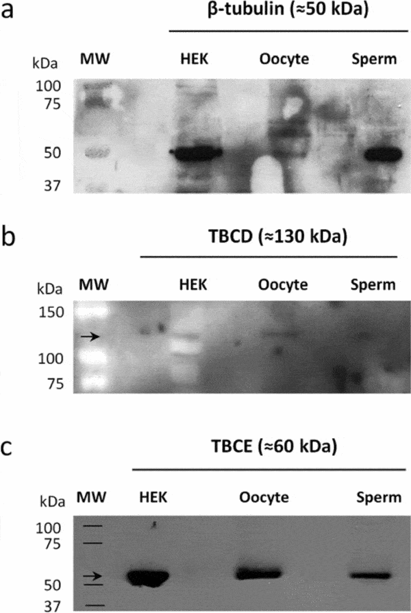 Expression and localization of tubulin cofactors TBCD and TBCE in human ...