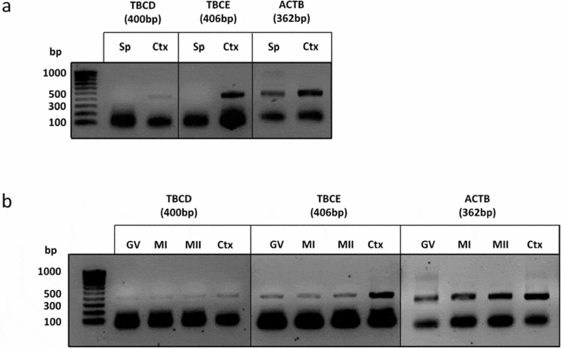 Expression and localization of tubulin cofactors TBCD and TBCE in human ...