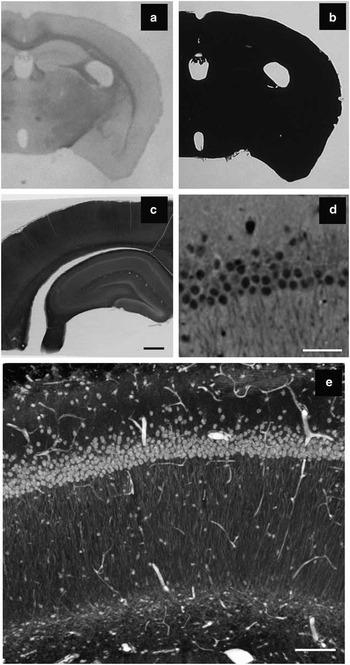 X-Ray Microscopy as an Approach to Increasing Accuracy and Efficiency ...