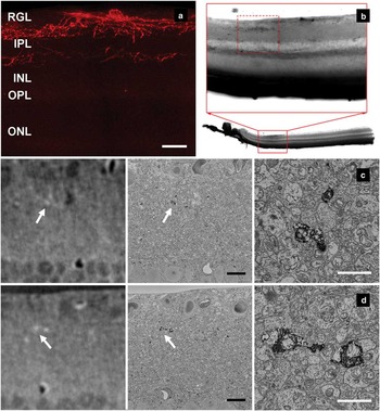 X-Ray Microscopy as an Approach to Increasing Accuracy and Efficiency ...