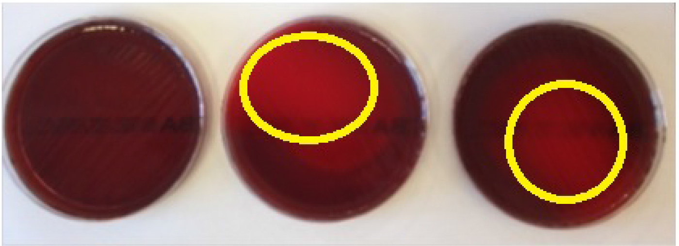 Optimising the use of otowicks in otitis externa | The Journal of ...