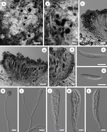 A new species of Llimoniella (Ascomycota, Helotiales) on Ramboldia ...