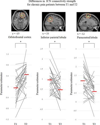 Changes in resting-state brain networks after cognitive–behavioral ...