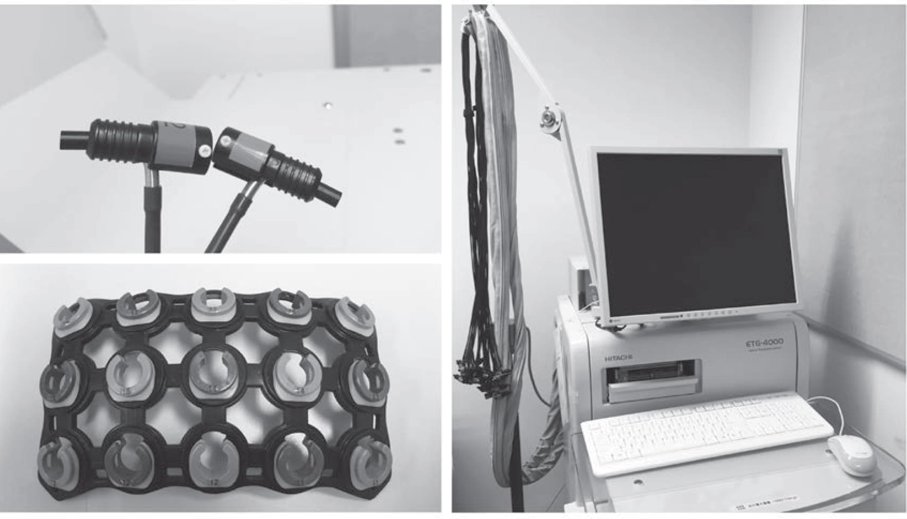 Functional Near Infrared Spectroscopy In Psychiatry Bjpsych Advances Cambridge Core