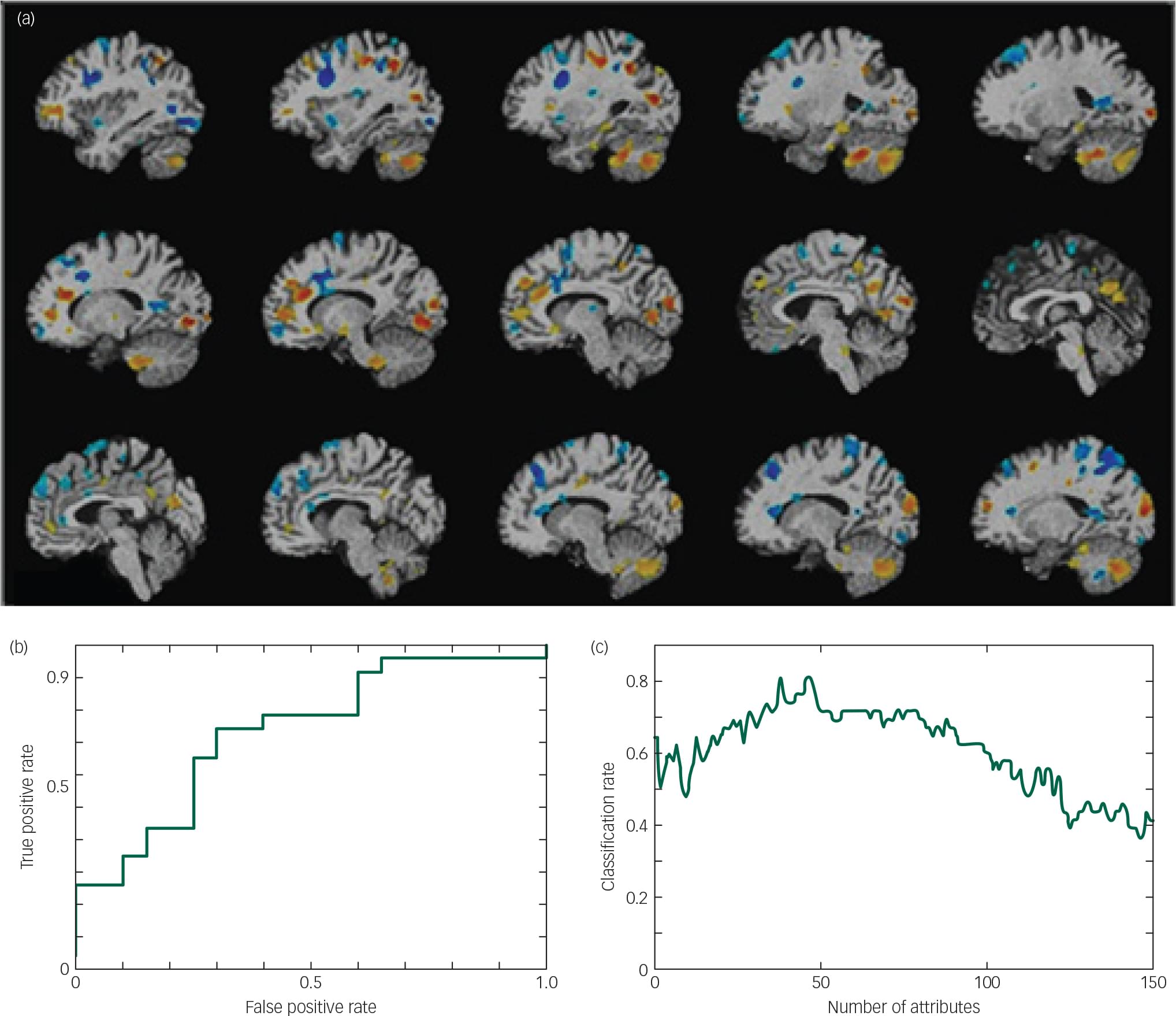 Diagnostic potential of structural neuroimaging for depression from a ...