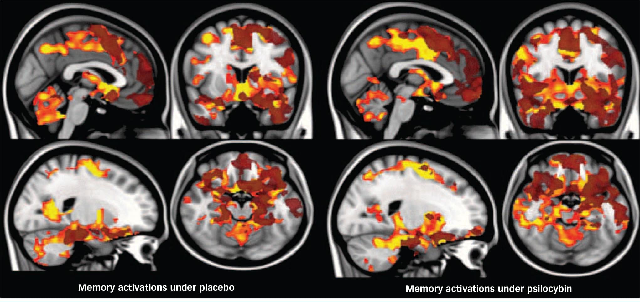 Implications for psychedelic-assisted psychotherapy: functional ...