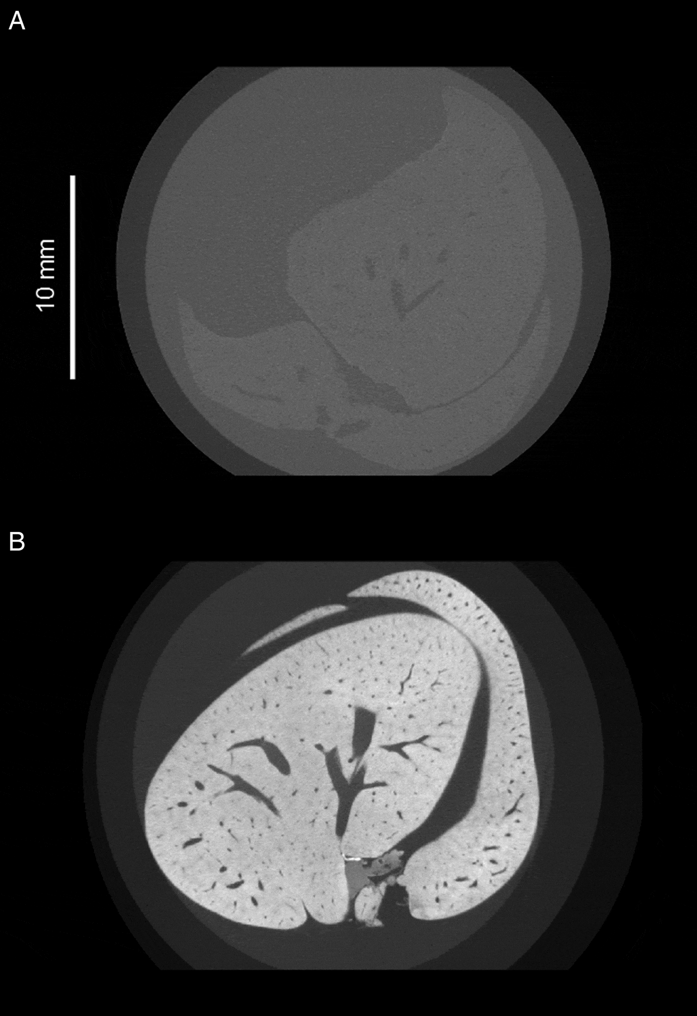 X-ray micro-computed tomography (μCT): an emerging opportunity in ...
