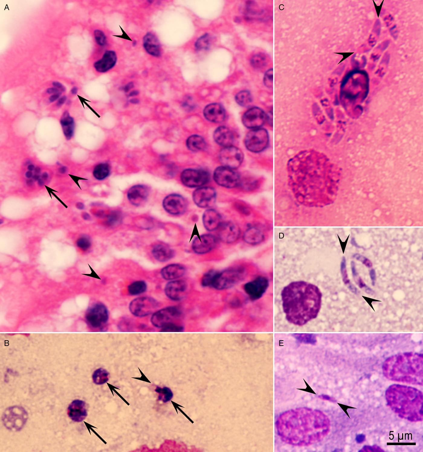Re-evaluation of the life cycle of Eimeria maxima Tyzzer, 1929 in ...