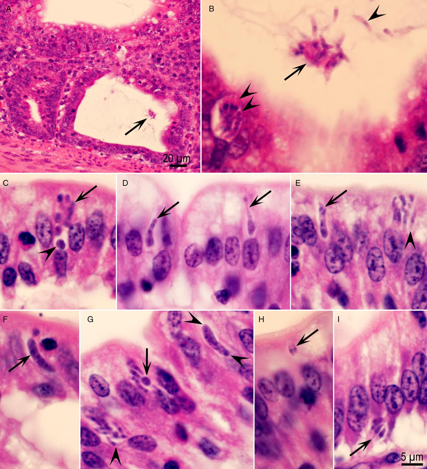 Re-evaluation of the life cycle of Eimeria maxima Tyzzer, 1929 in ...