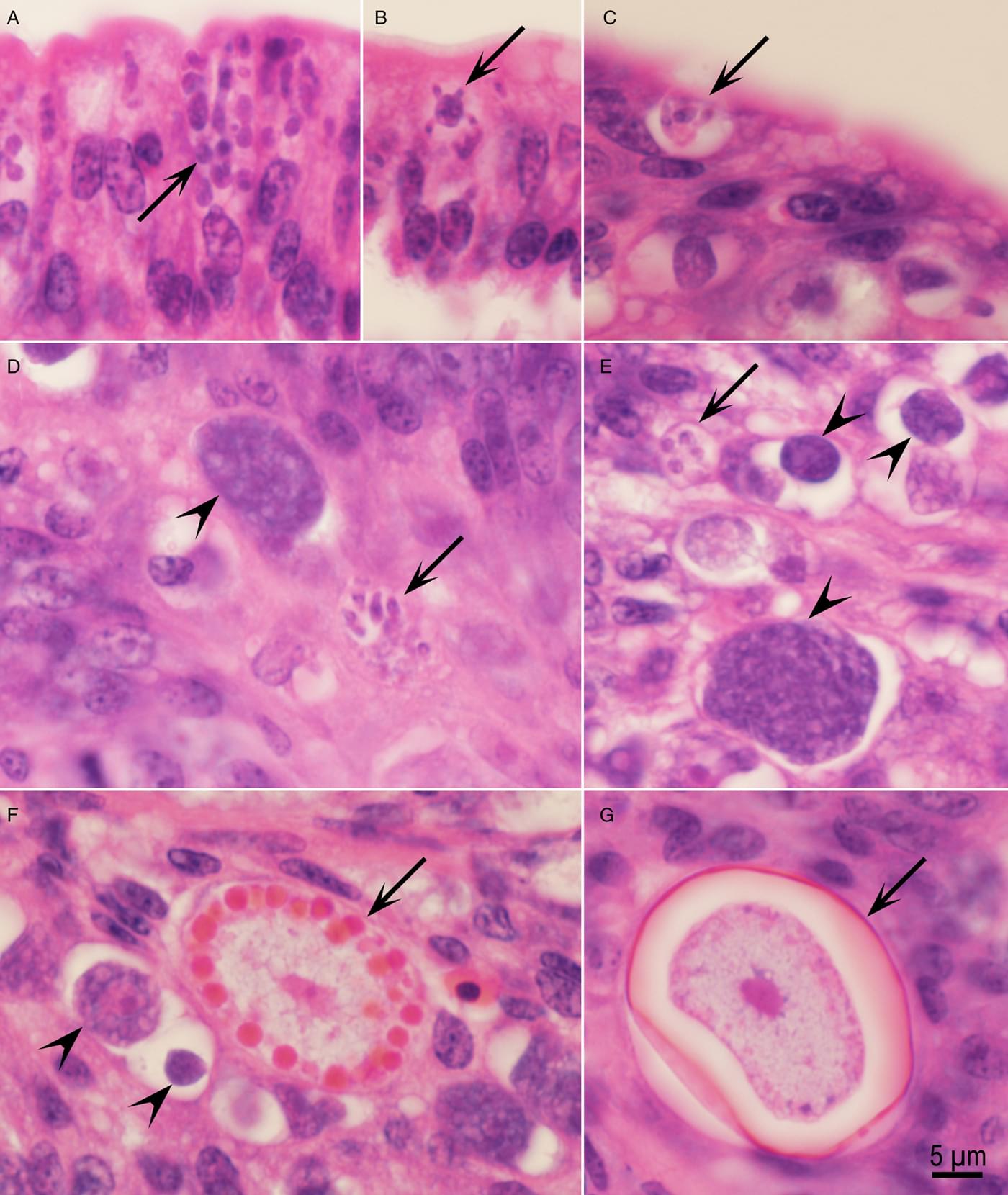Re-evaluation of the life cycle of Eimeria maxima Tyzzer, 1929 in ...