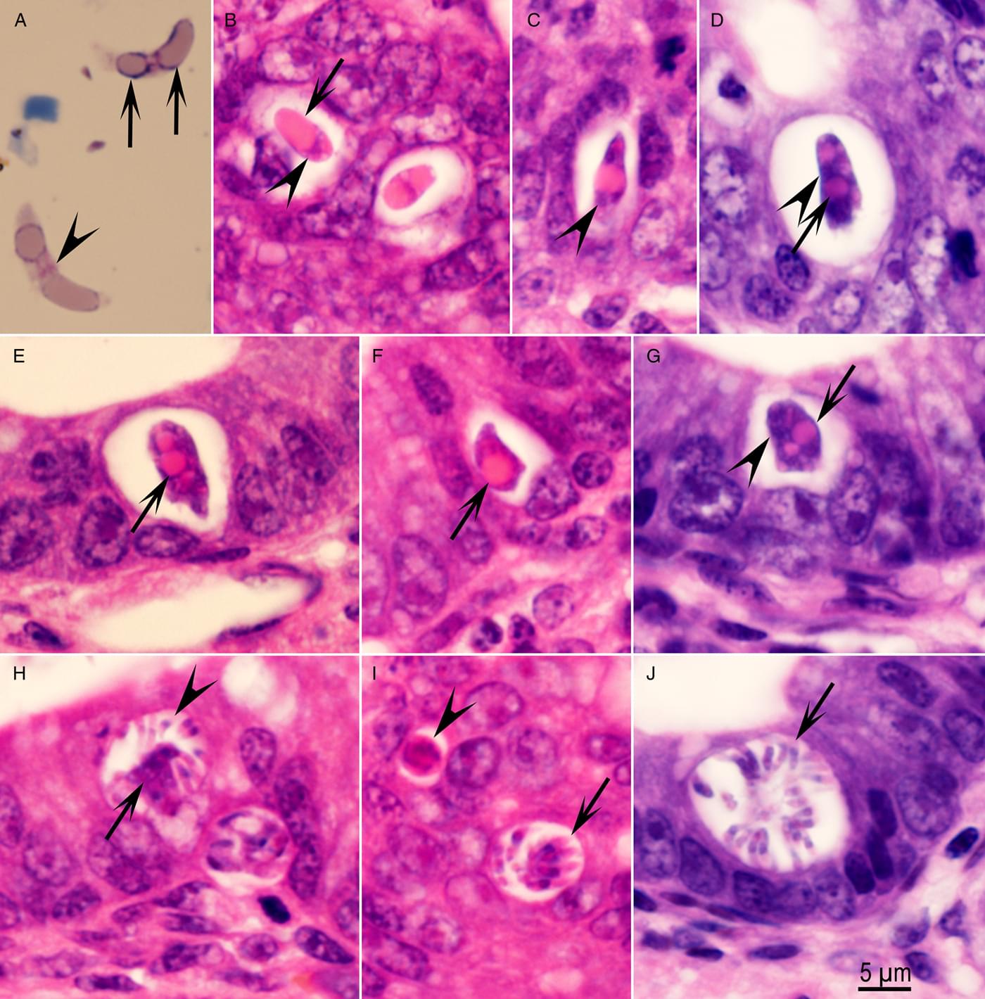 Re-evaluation of the life cycle of Eimeria maxima Tyzzer, 1929 in ...