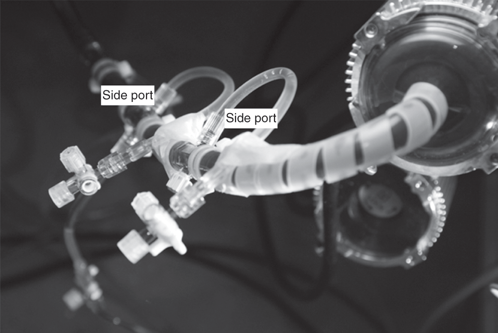 The ECMO circuit (Chapter 3) - ECMO in the Adult Patient
