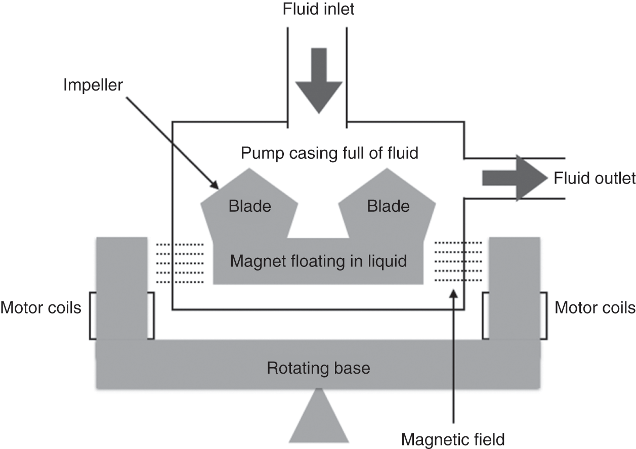 The ECMO circuit (Chapter 3) - ECMO in the Adult Patient