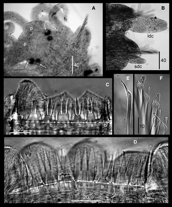 Proceraea janetae sp. nov. (Annelida, Syllidae, Autolytinae), a ...