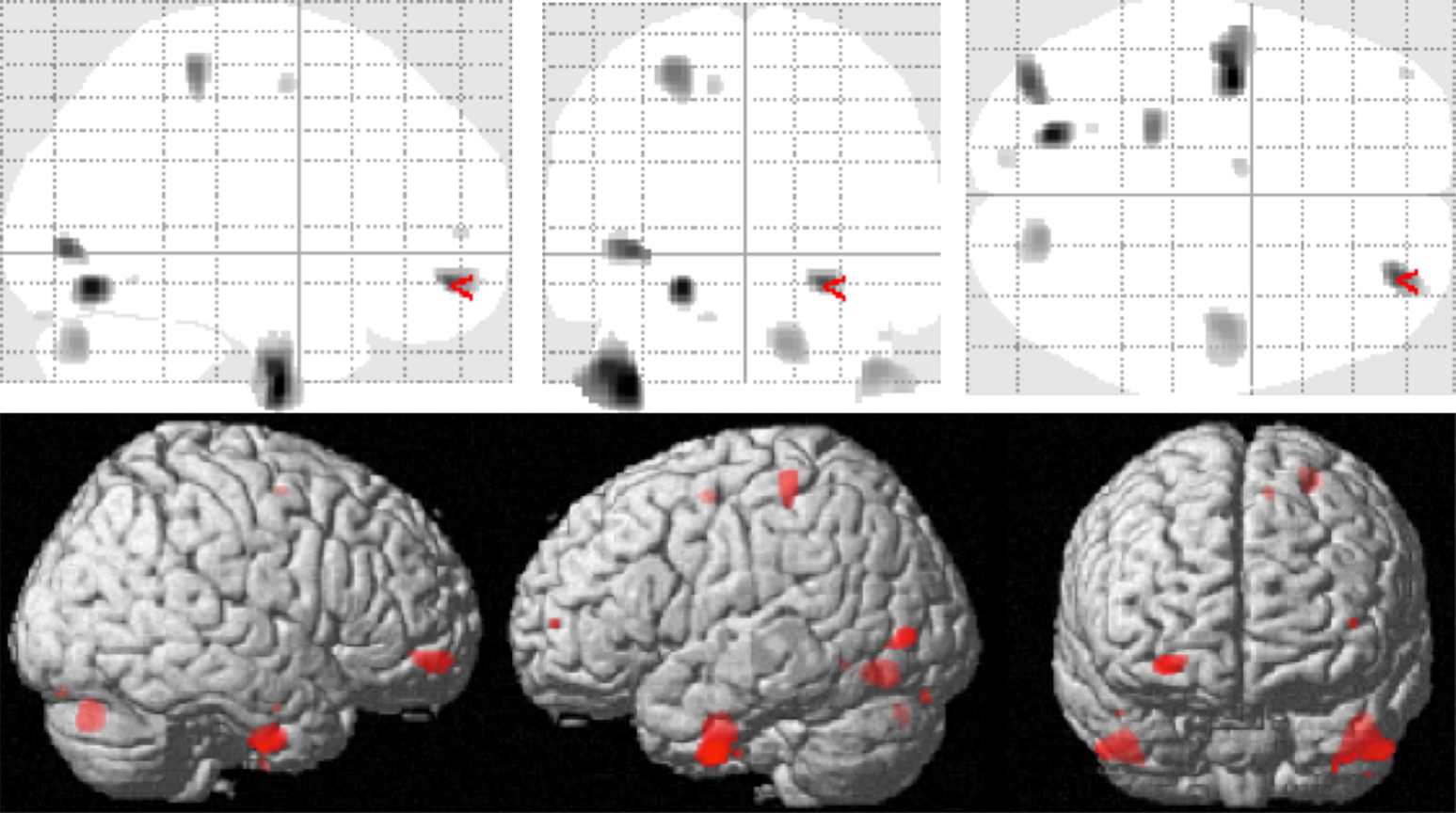Brain structure and symptom dimensions in borderline personality ...