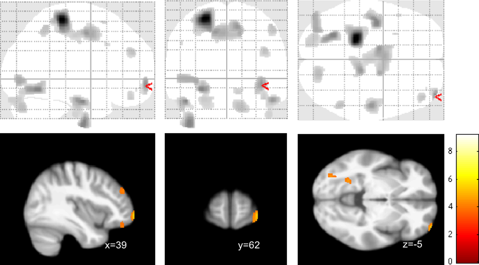 Brain structure and symptom dimensions in borderline personality ...