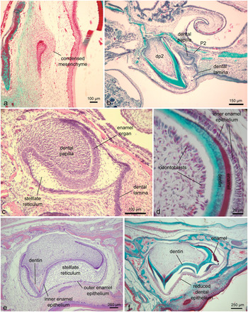 Tooth Histology Labeled