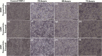 Synthesis and characterization of citrus-derived pectin nanoparticles ...