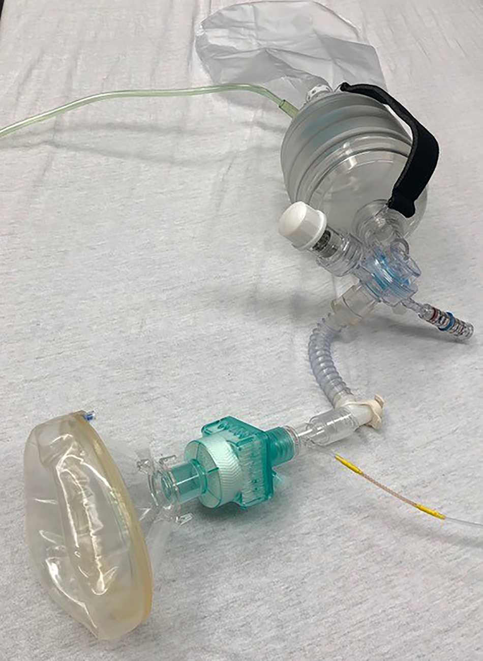 Just the Facts: Airway management during the coronavirus disease 2019 ...