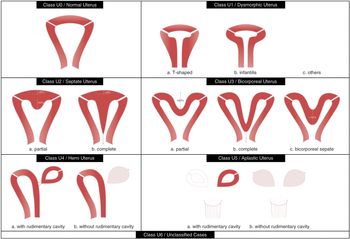 Anatomy and Physiology of the Uterus (Chapter 2) - Diagnostic and ...