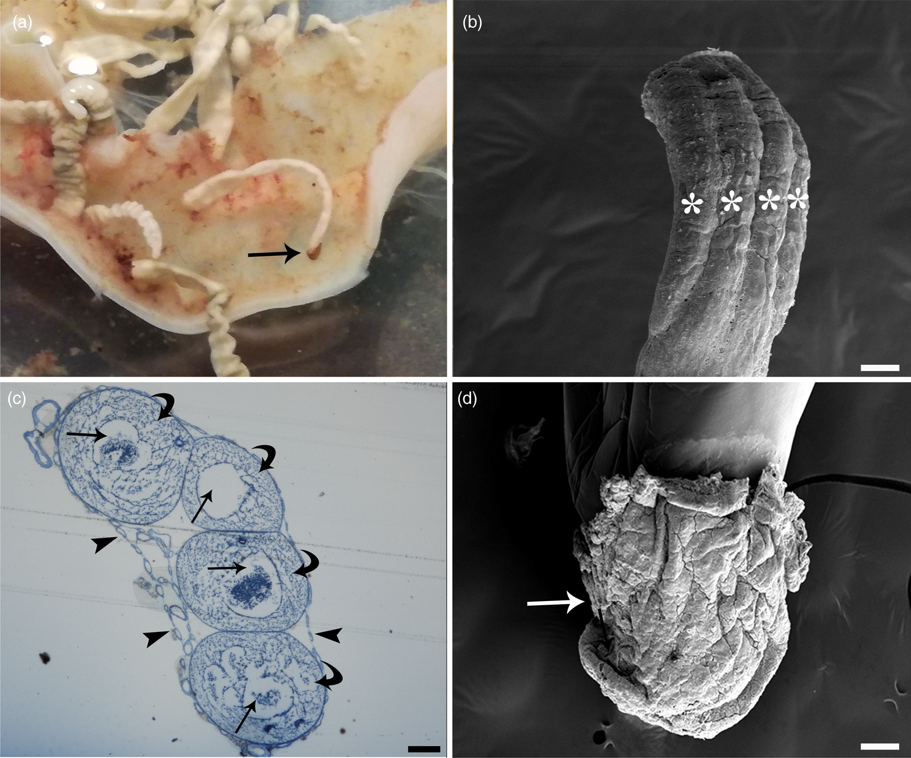 Ultrastructure of male Centrorhynchus globocaudatus (Acanthocephala ...