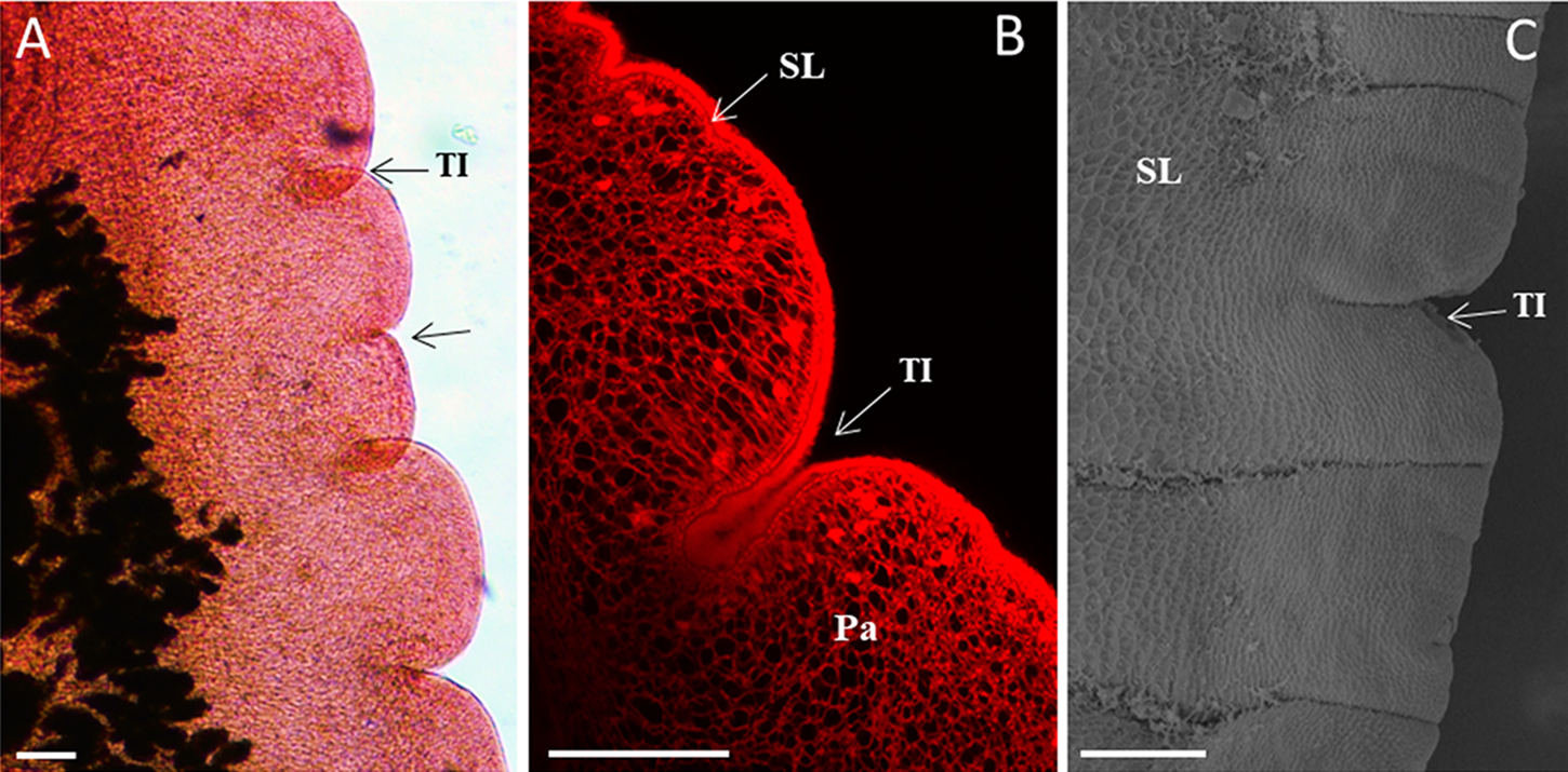 Eurytrema coelomaticum: updated morphology of adult worms using ...