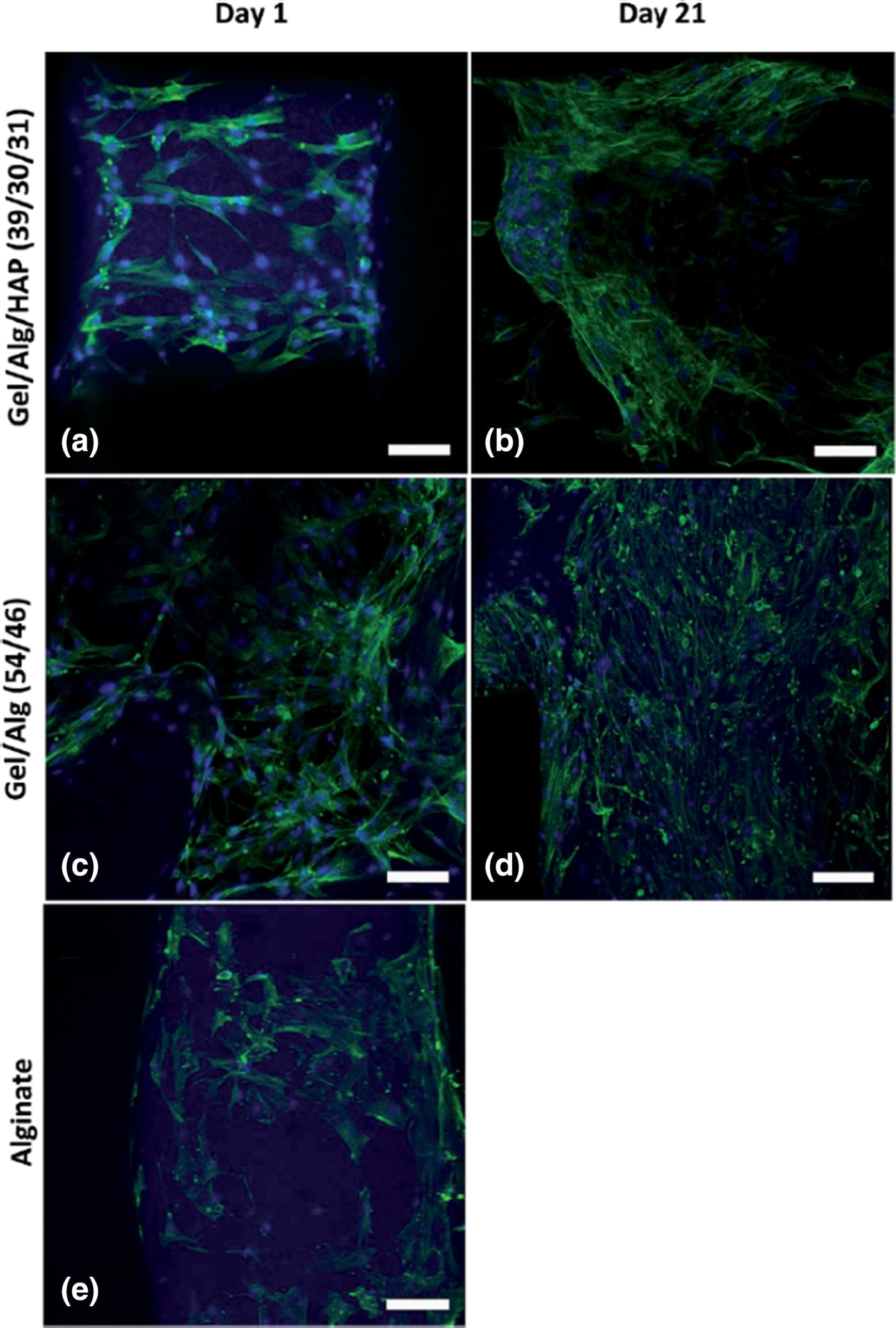 Gelatin-based hydrogels for biomedical applications | MRS ...