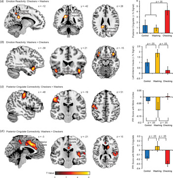 Functional connectivity in obsessive-compulsive disorder and its ...