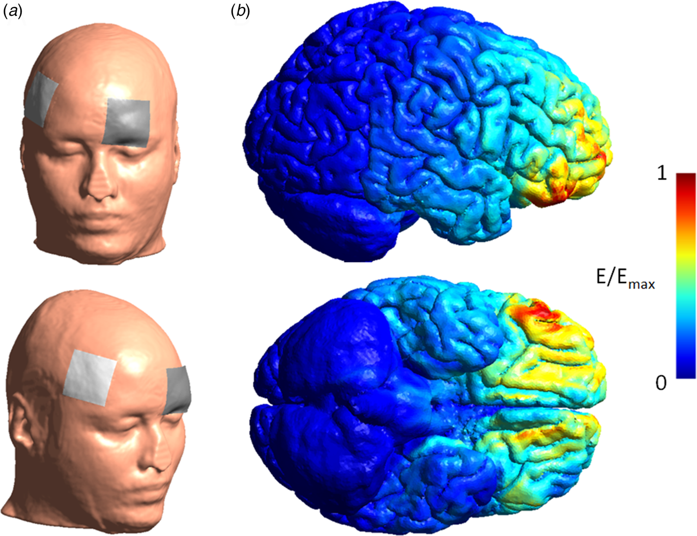 Improving emotion regulation of social exclusion in depression-prone ...