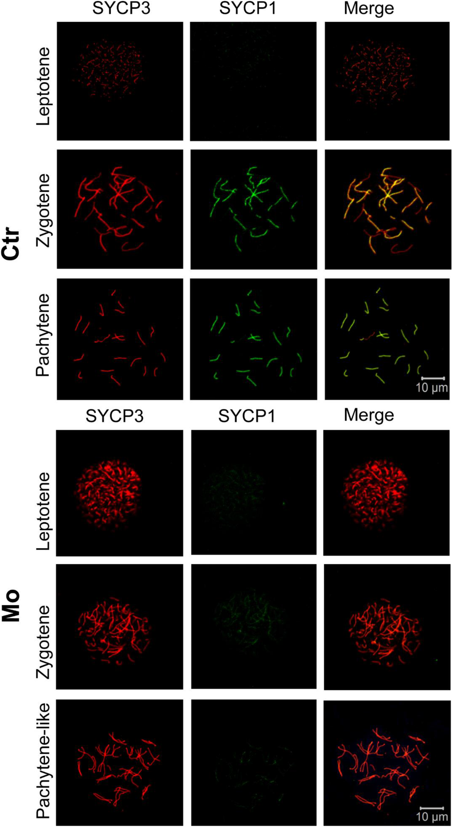 Transferrin receptor (TFRC) is essential for meiotic progression during ...