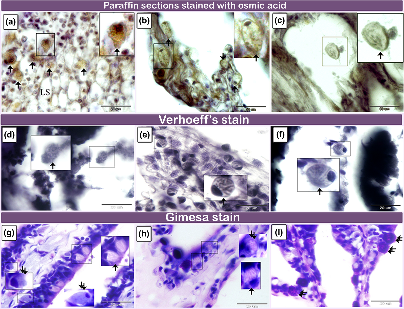 Migratory Activities and Stemness Properties of Rodlet Cells ...