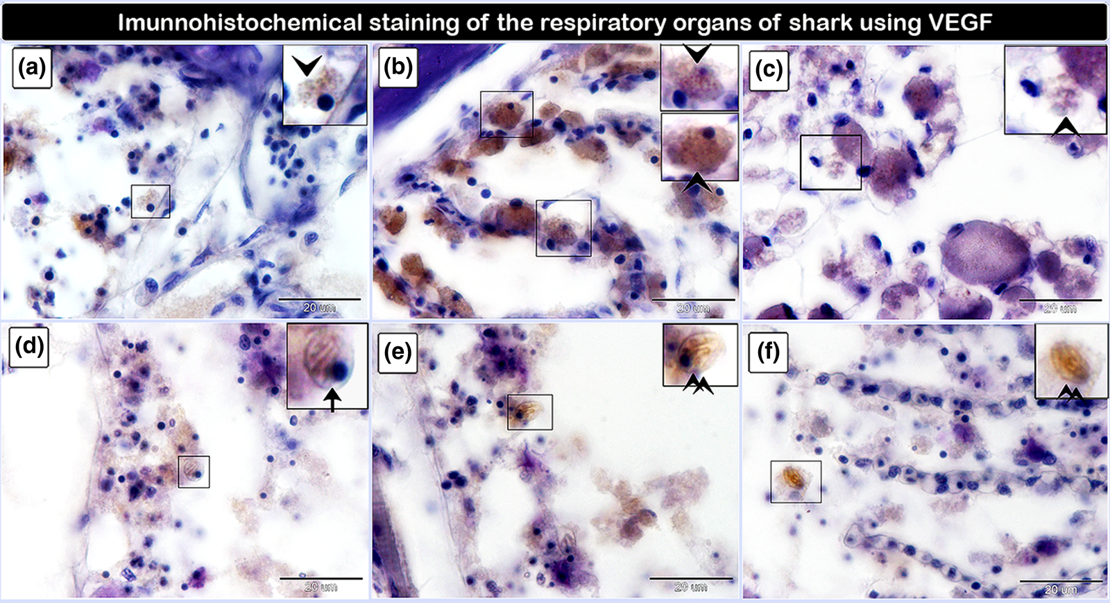 Migratory Activities and Stemness Properties of Rodlet Cells ...