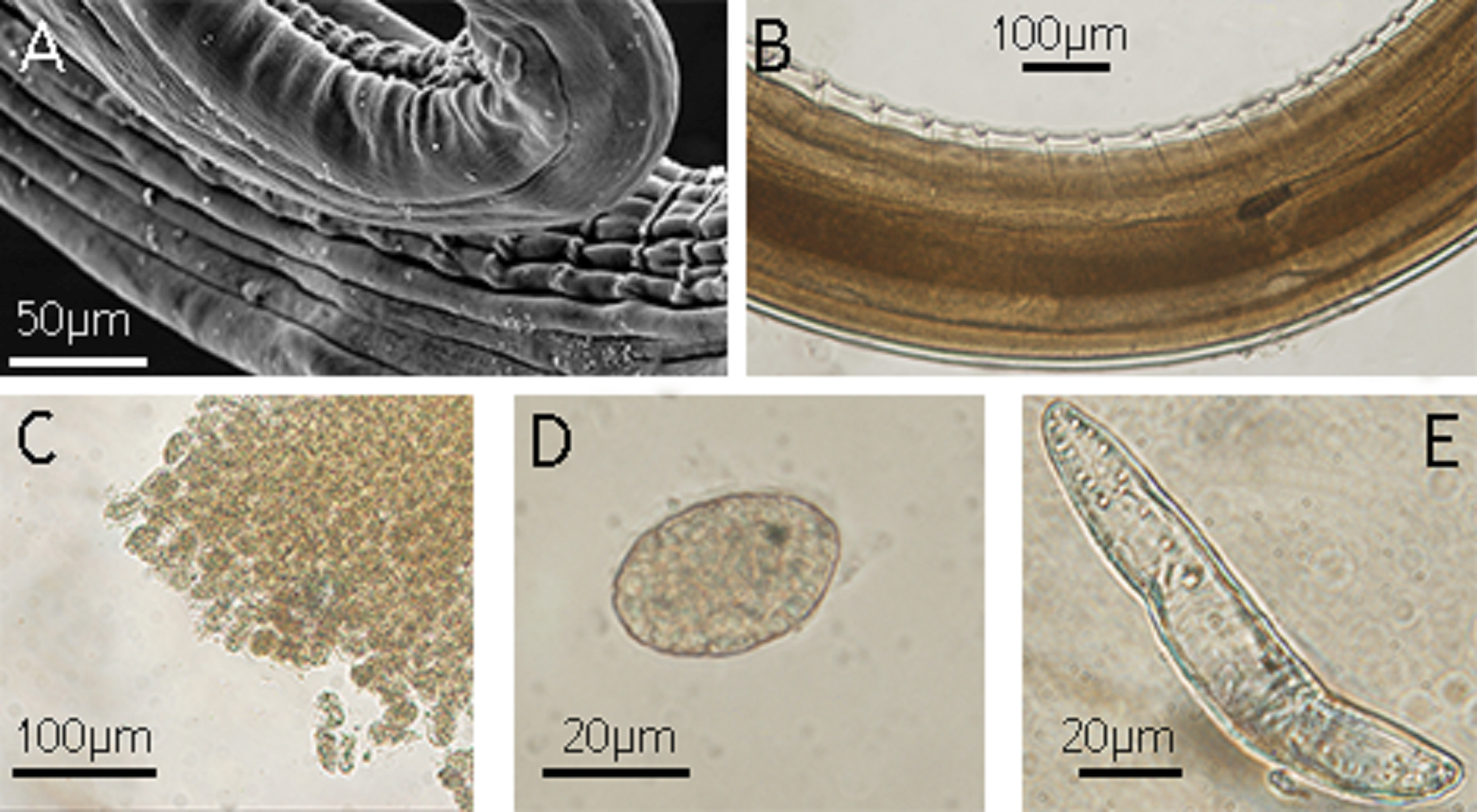 Setaria cervi (Filarioidea, Onchocercidae) undressing in ungulates ...