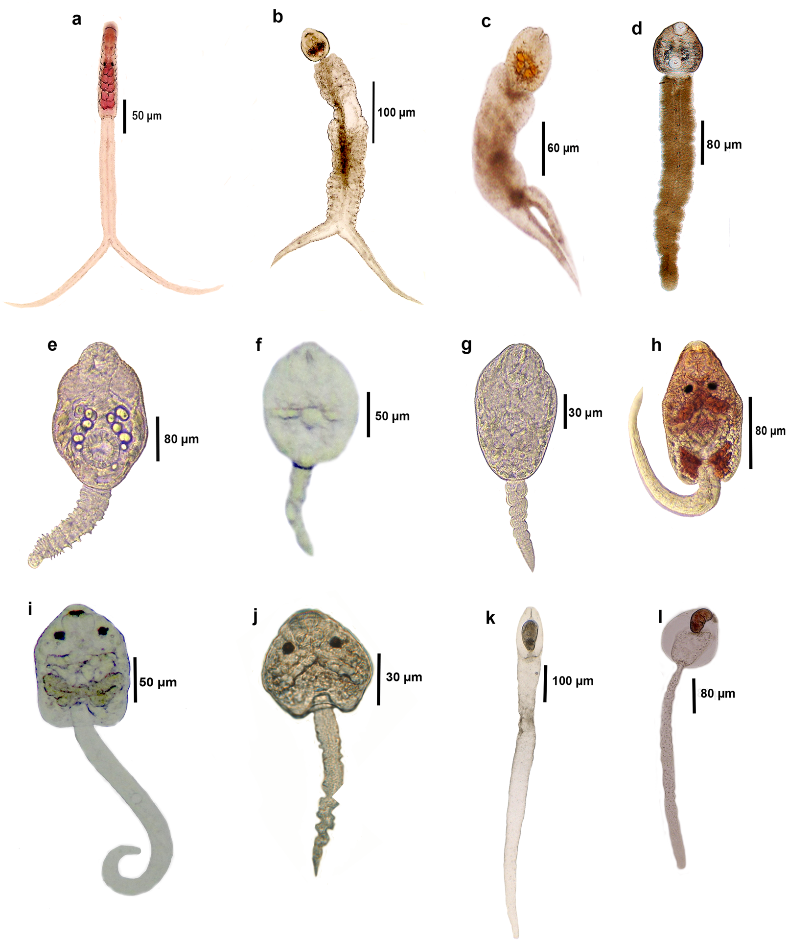 Morphological and molecular assessment of the diversity of trematode ...