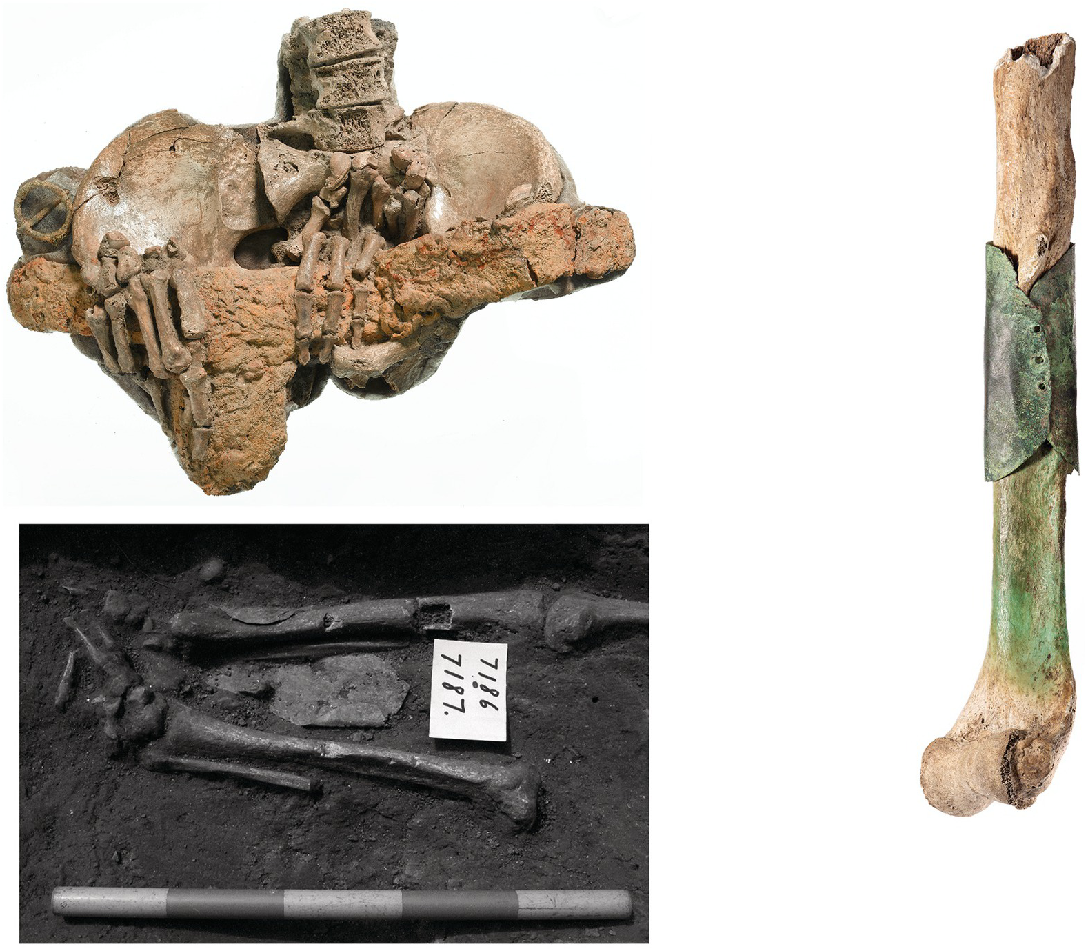 Spirit, Mind and Body: The Archaeology of Monastic Healing (Three ...