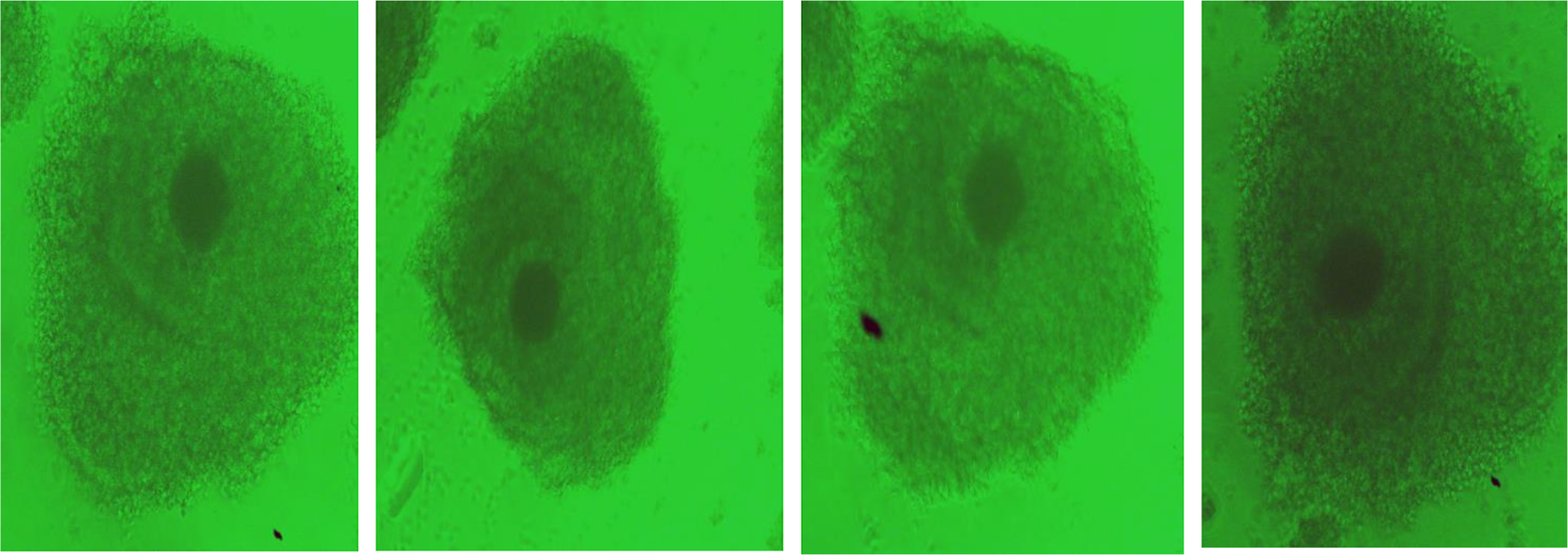 Differential molecular and hormonal changes in oocytes, granulosa cells ...