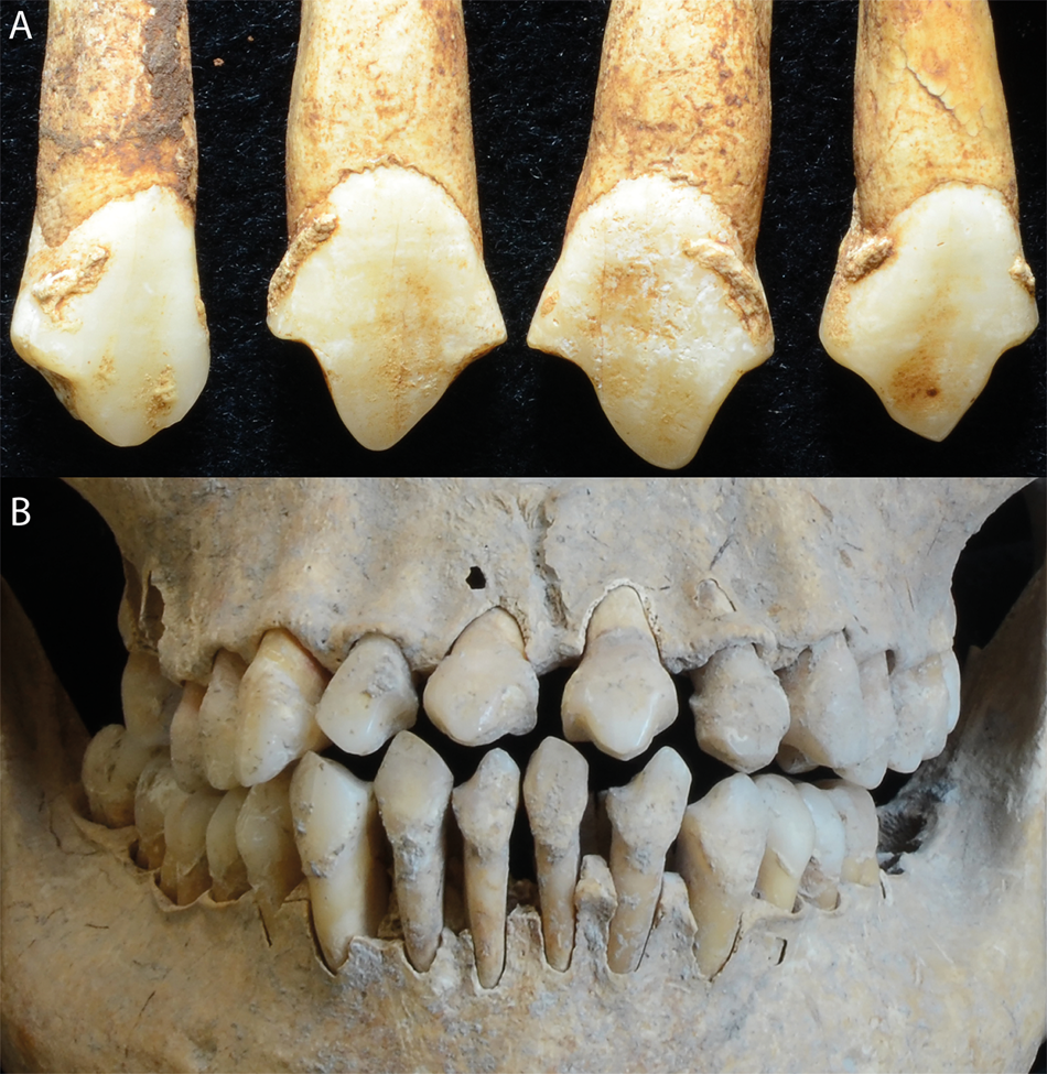 Social Identity and Dental Modification at the Postclassic Maya Urban ...