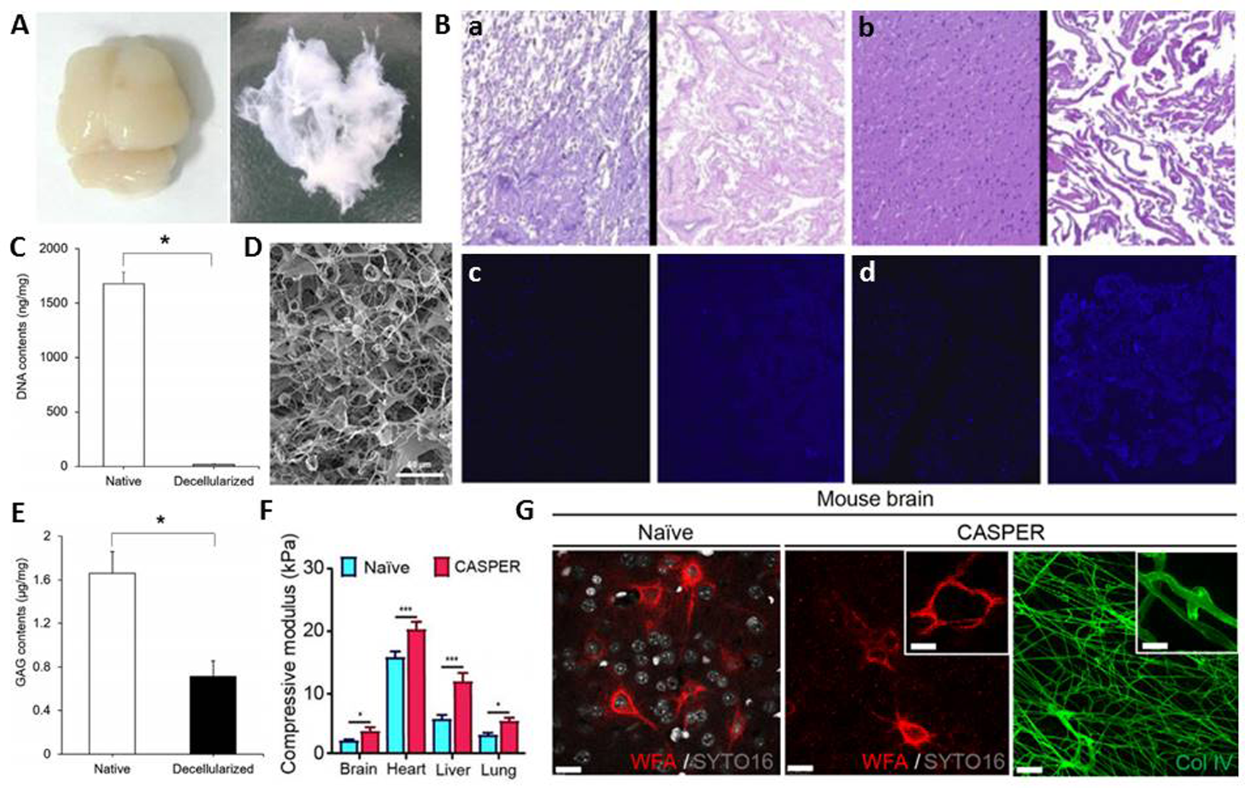 Decellularised extracellular matrix-based biomaterials for repair and ...
