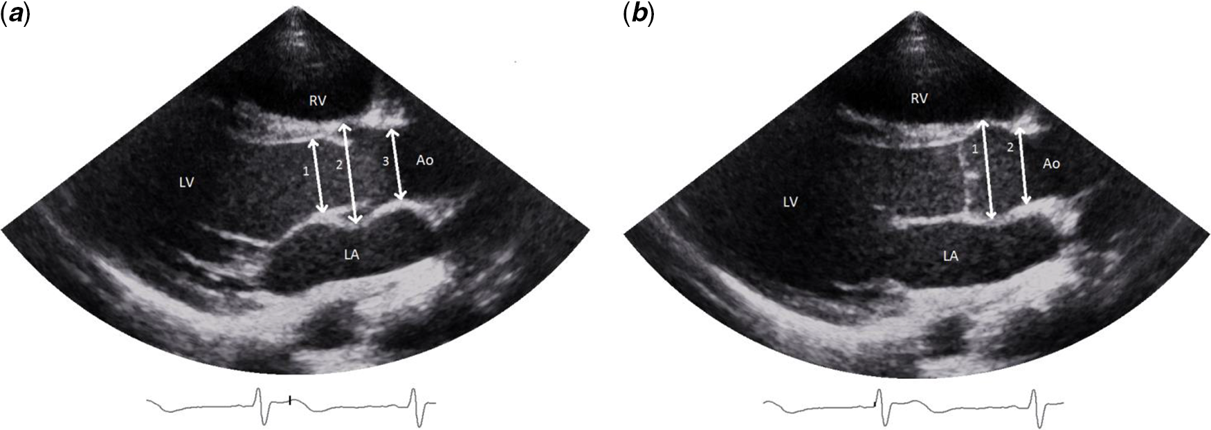 Comparability of different Z-score equations for aortic root dimensions ...