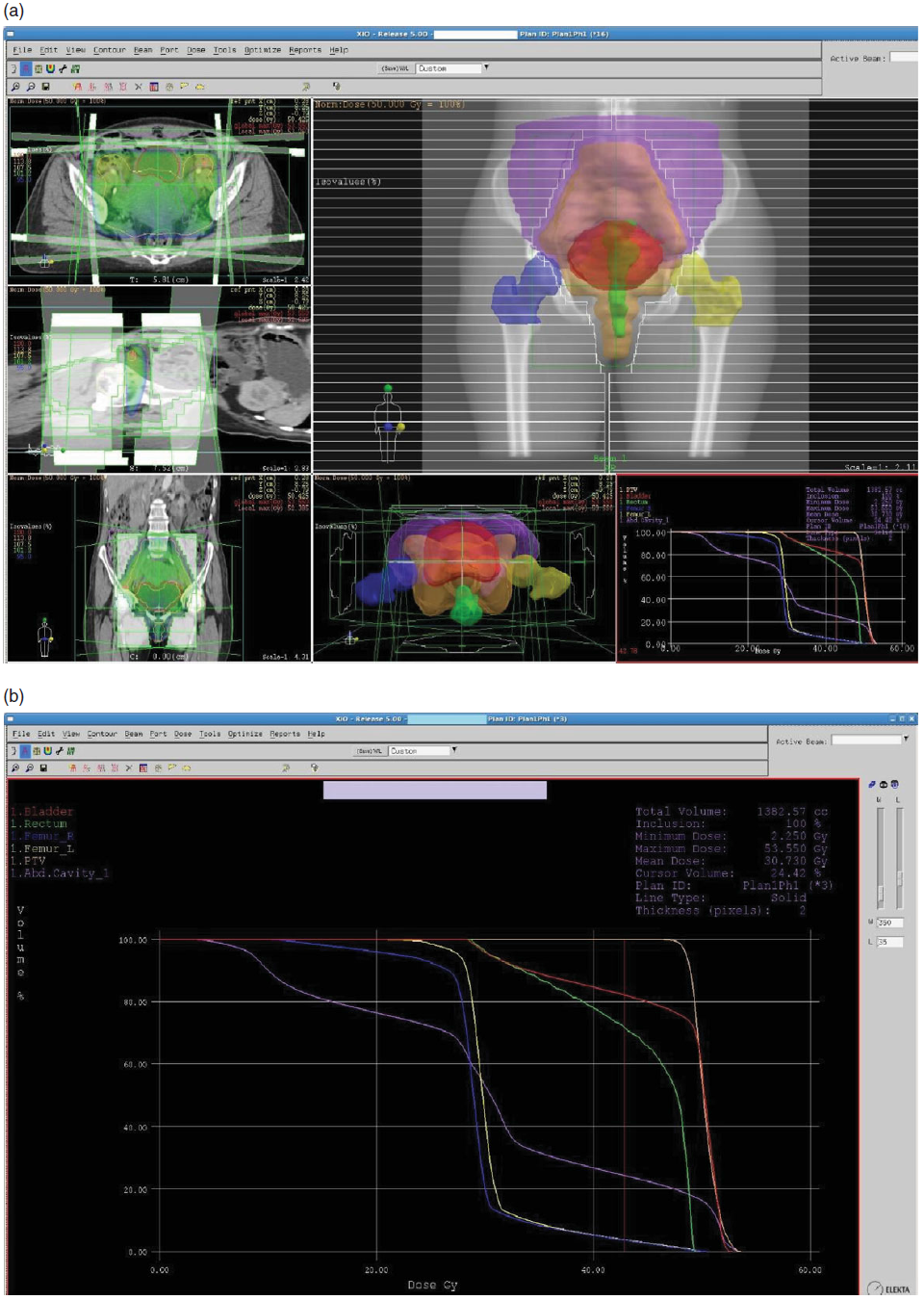 Dosimetric comparison of 3-dimensional conformal radiotherapy (3D-CRT ...