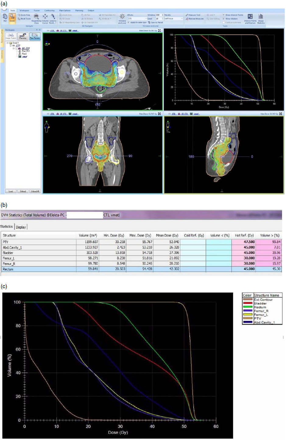 Dosimetric comparison of 3-dimensional conformal radiotherapy (3D-CRT ...
